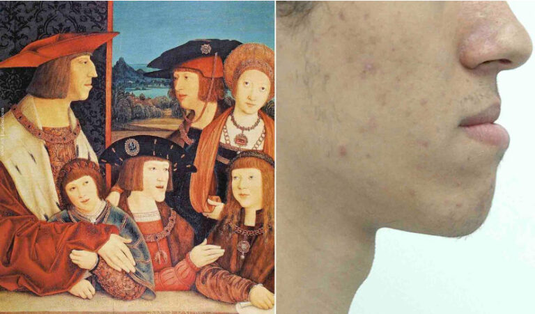 As mandíbulas grandes e a nobreza - Jornal Pequeno